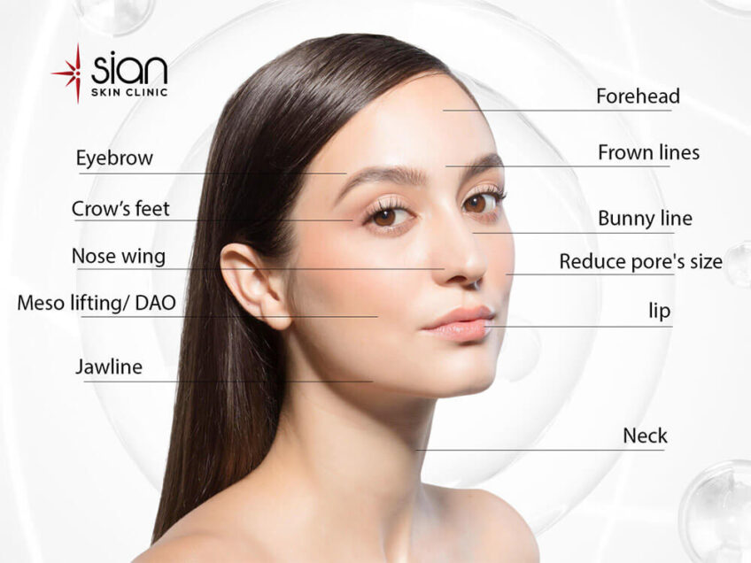 Botox injections – Cost, Procedure, Benefits, Side Effects & More ...