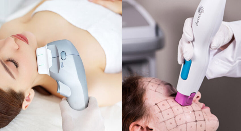 Thermage vs HIFU – Which Option Is Best for Me? - SIAN Skin Clinic