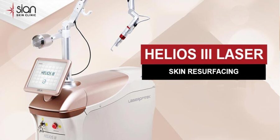 Skin Resurfacing with Helios Laser Treatment - SIAN Skin Clinic