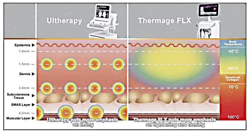 Thermage vs Ultherapy: What is the Difference? - SIAN Skin Clinic