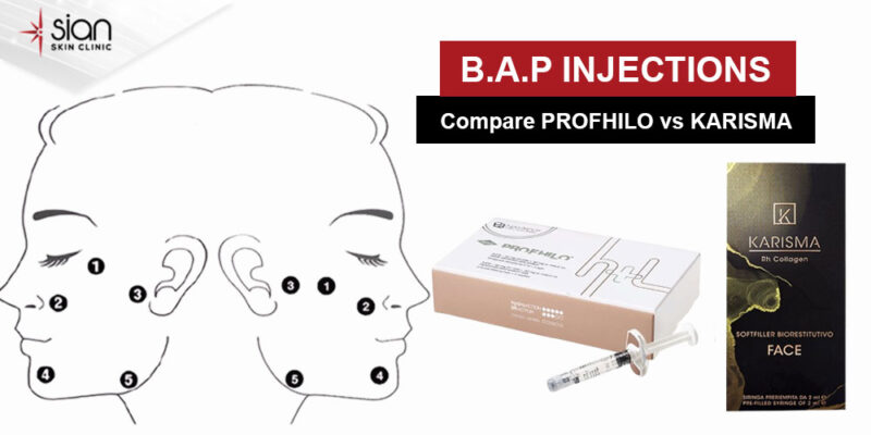 Compare Profhilo vs Karisma – which BAP injection is better? - SIAN ...