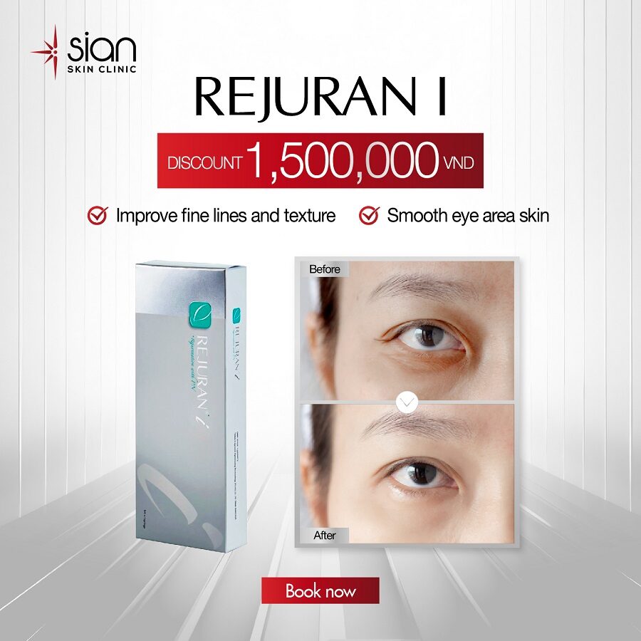 5 Benefits of Rejuran Eye Injection Treatment - SIAN Skin Clinic